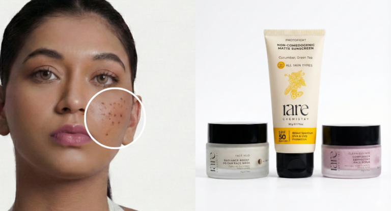 Decoding Dark Spots in Indian Skin | Hyperpigmentation Guide | Rare ...